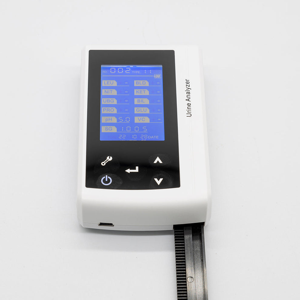 Mini Urinalysis Test Machine Handheld Urine Analyzer ...