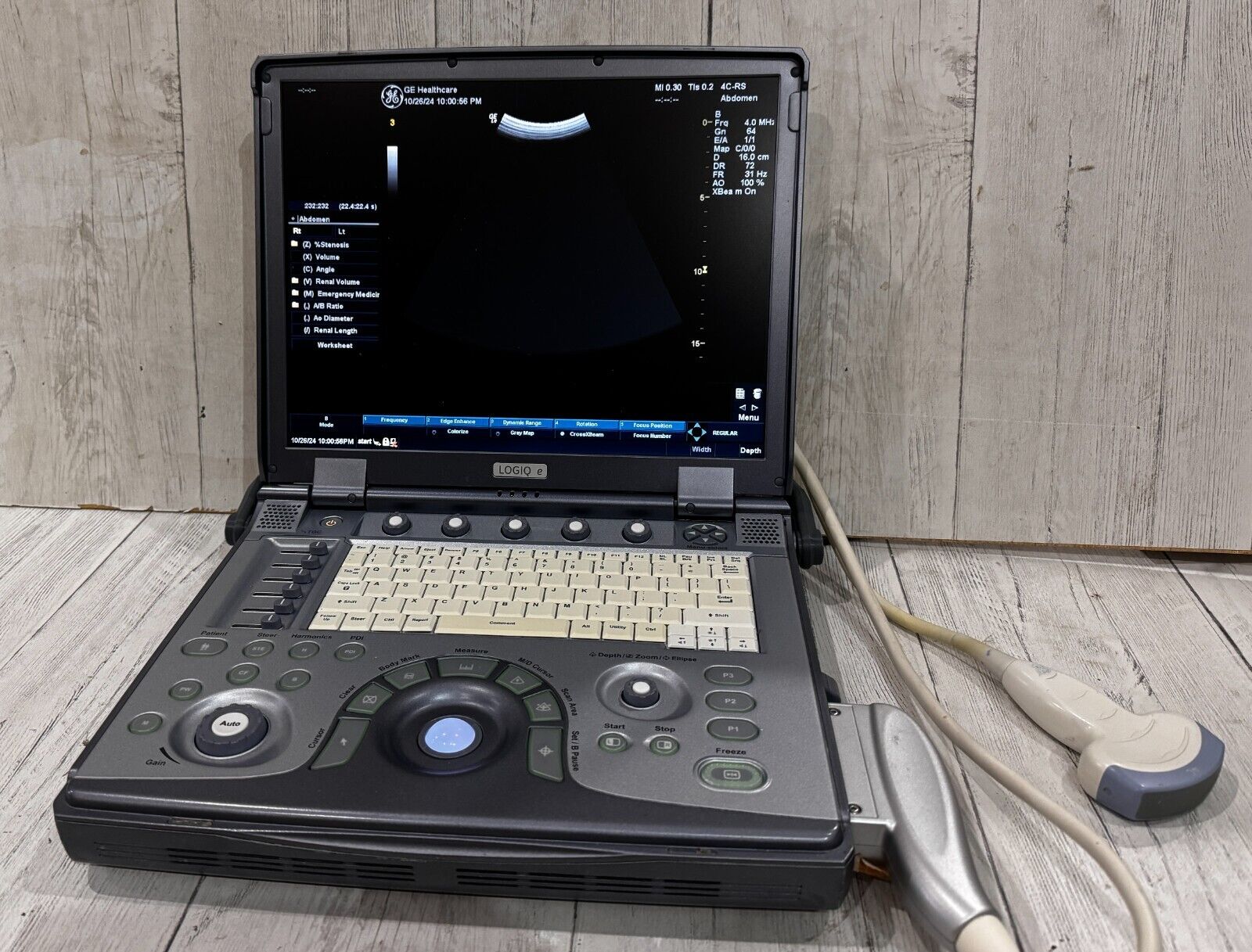 GE Logiq E portable ultrasound 2011 with 4C-Rs Abdominal Probe ...