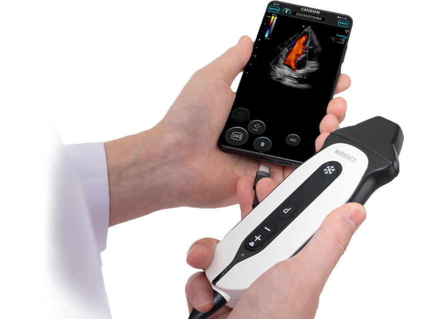 Handheld Digital Color Doppler Ultrasound System for Veterinary SonoEye ...