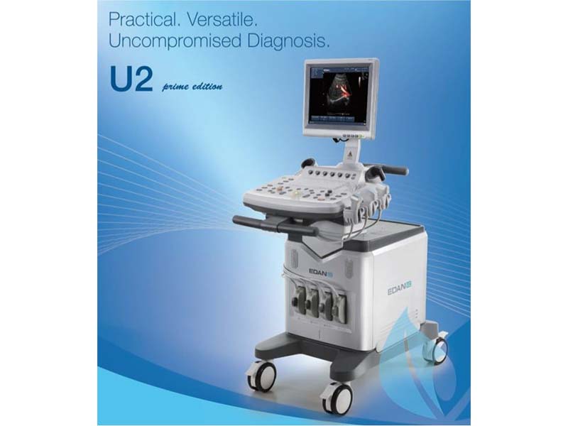 Edan U2 Cart-Based Color Doppler Ultrasound – GlobalHeathcareMedical