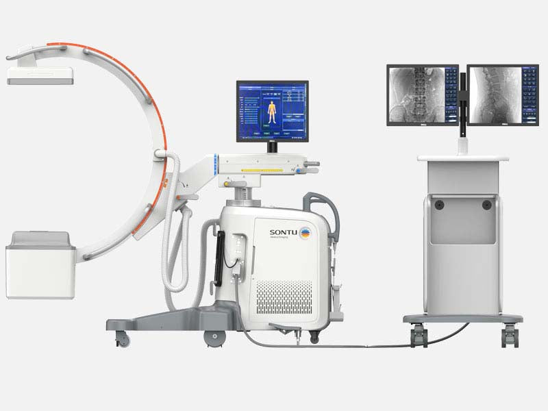 Mobile C-arm System – GlobalHeathcareMedical
